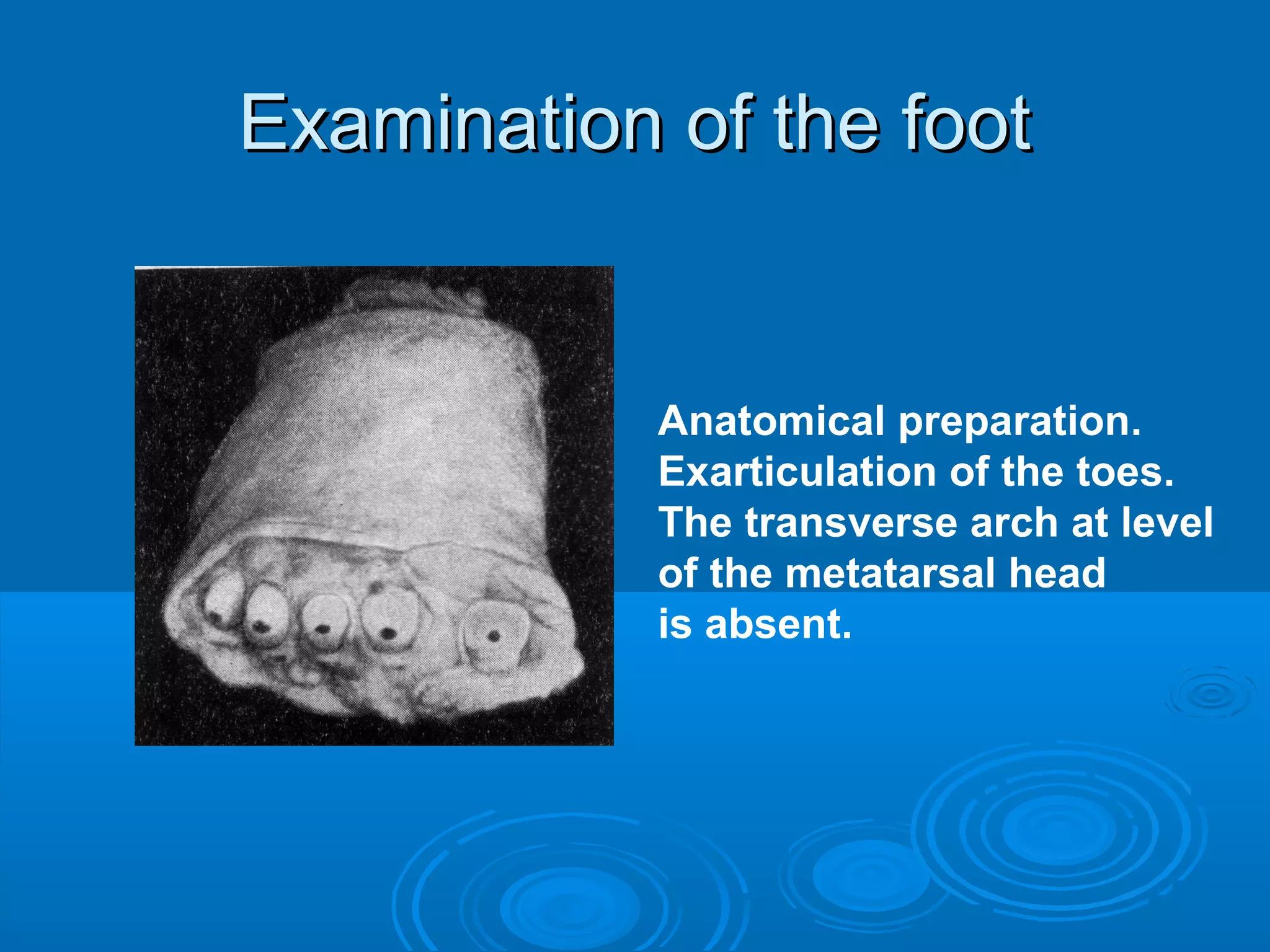 Deformities of the Foot | PPT