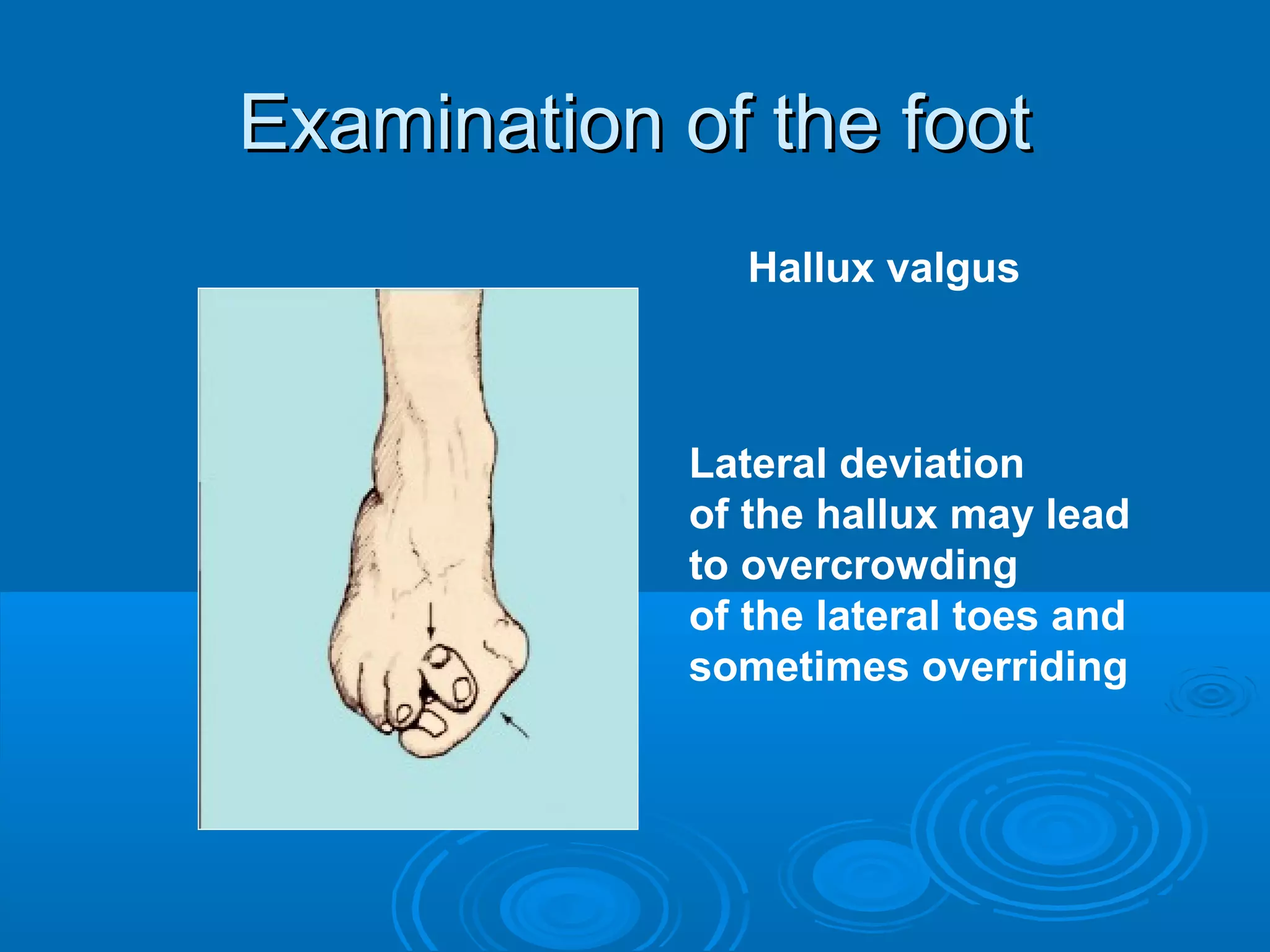 Deformities of the Foot | PPT