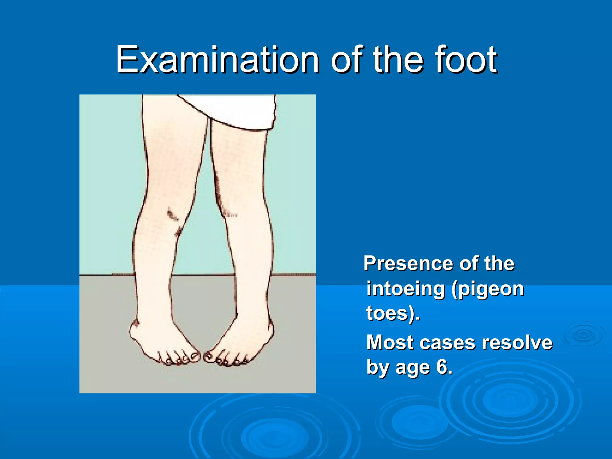 Deformities of the Foot | PPT