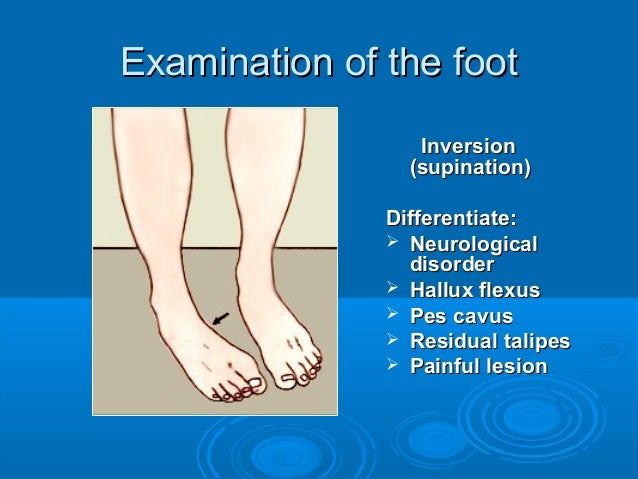 Deformities of the Foot