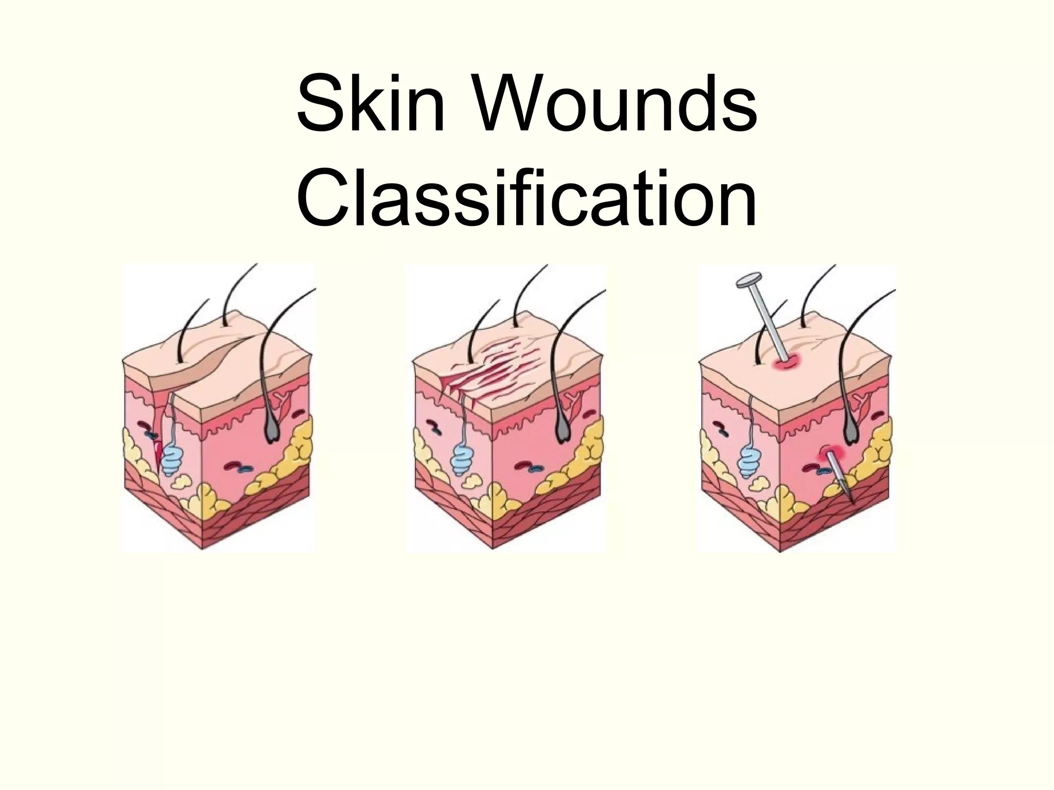 Skin wounds. Classification | PPT
