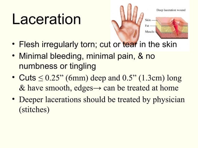 Skin wounds. Classification | PPT | First Aid | Injuries