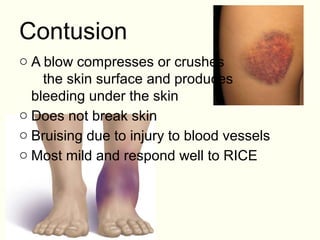 Skin wounds. Classification | PPT