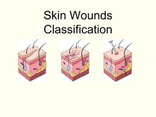 Types Of Skin Wounds