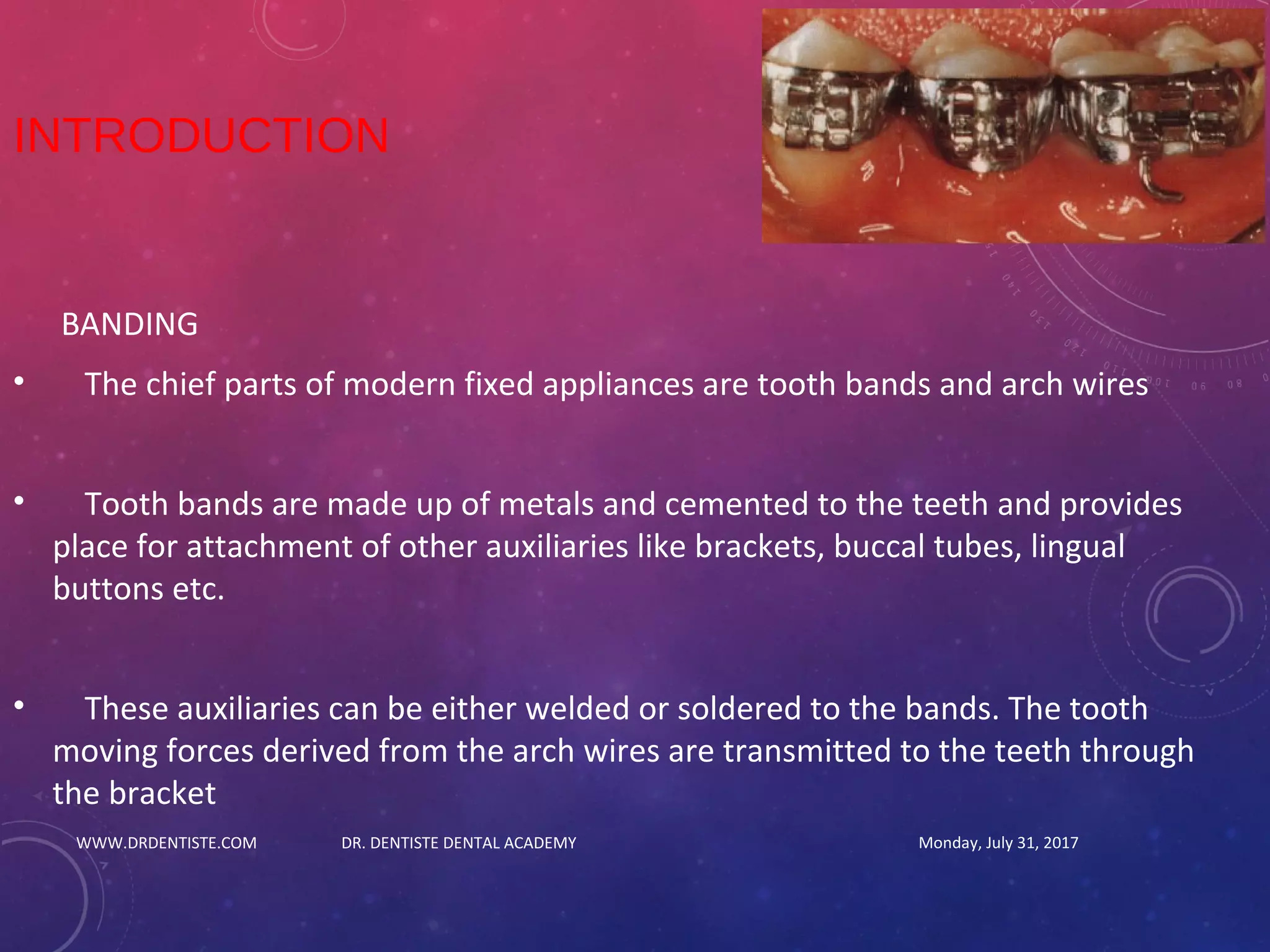 BANDING AND BONDING INN ORTHODONTICS | PPT