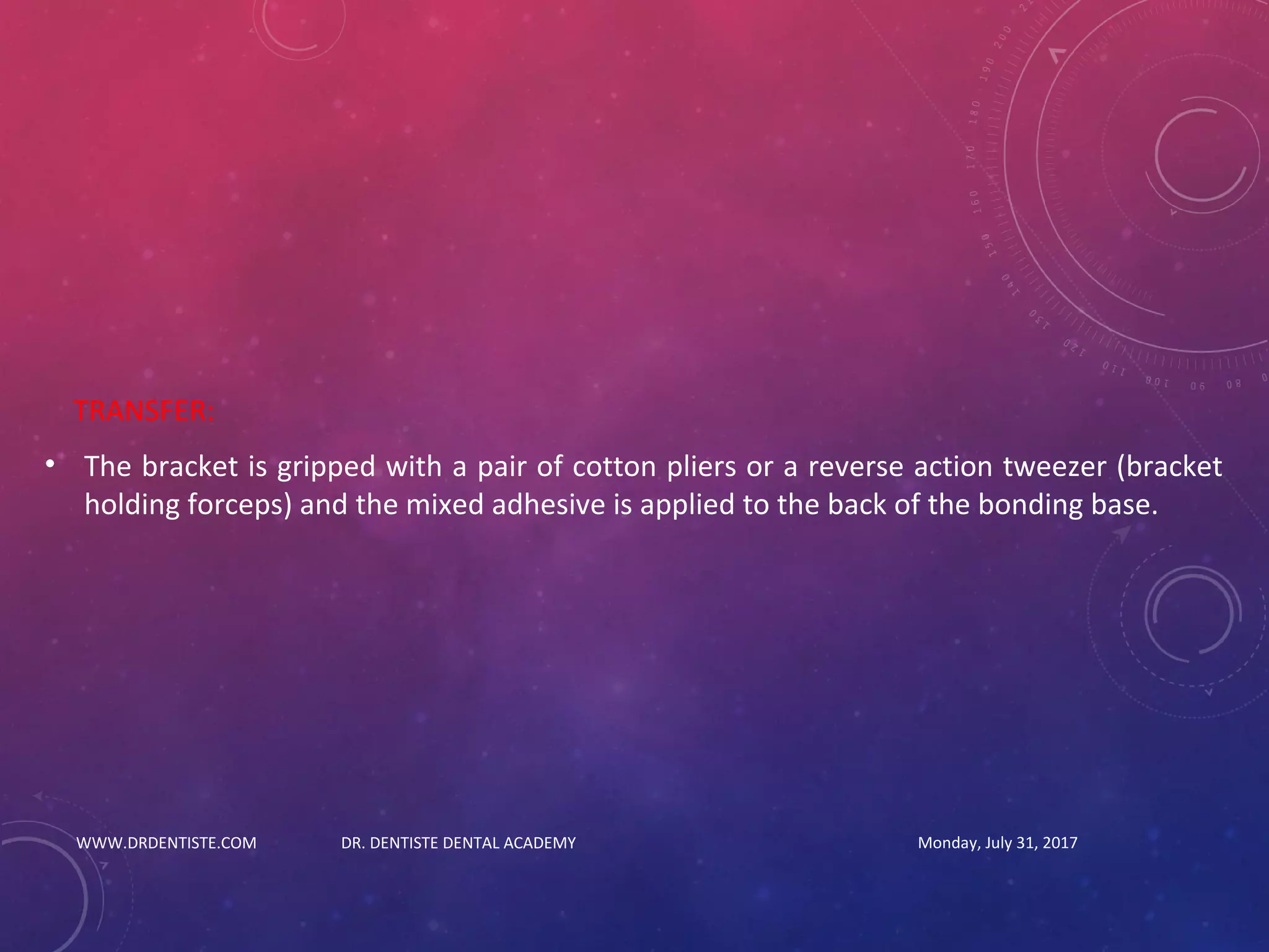 BANDING AND BONDING INN ORTHODONTICS | PPT