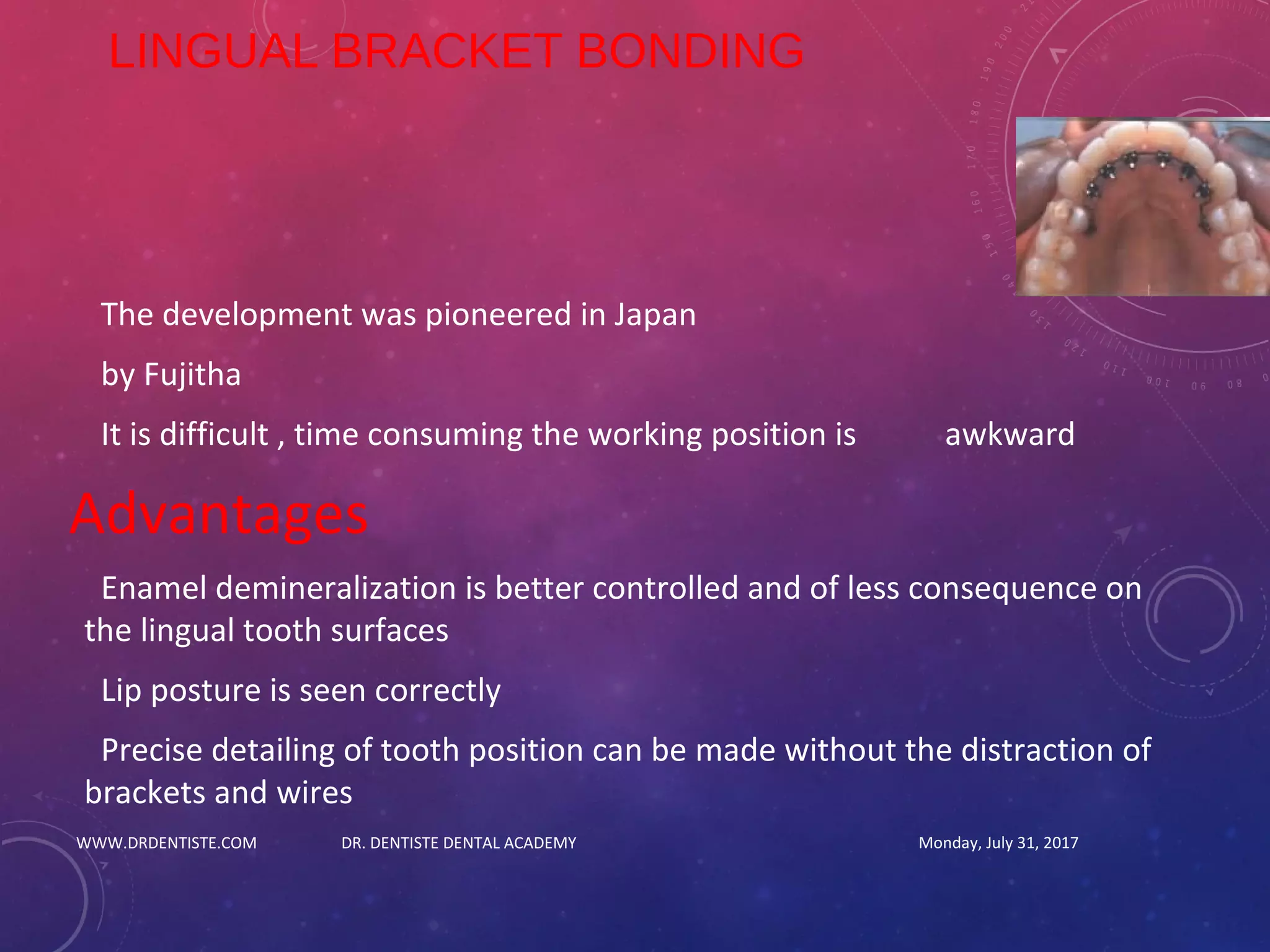BANDING AND BONDING INN ORTHODONTICS | PPT