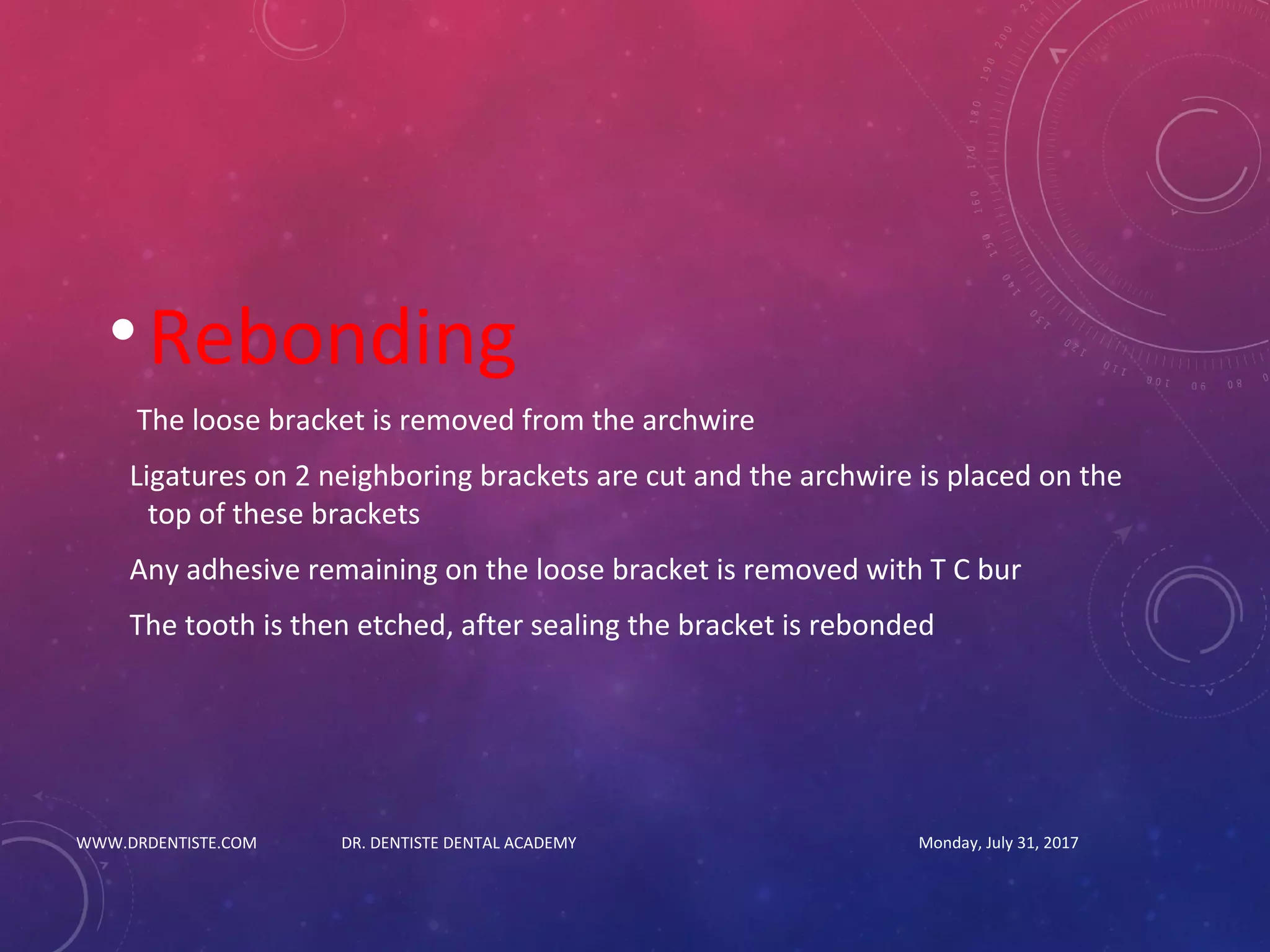 BANDING AND BONDING INN ORTHODONTICS | PPT