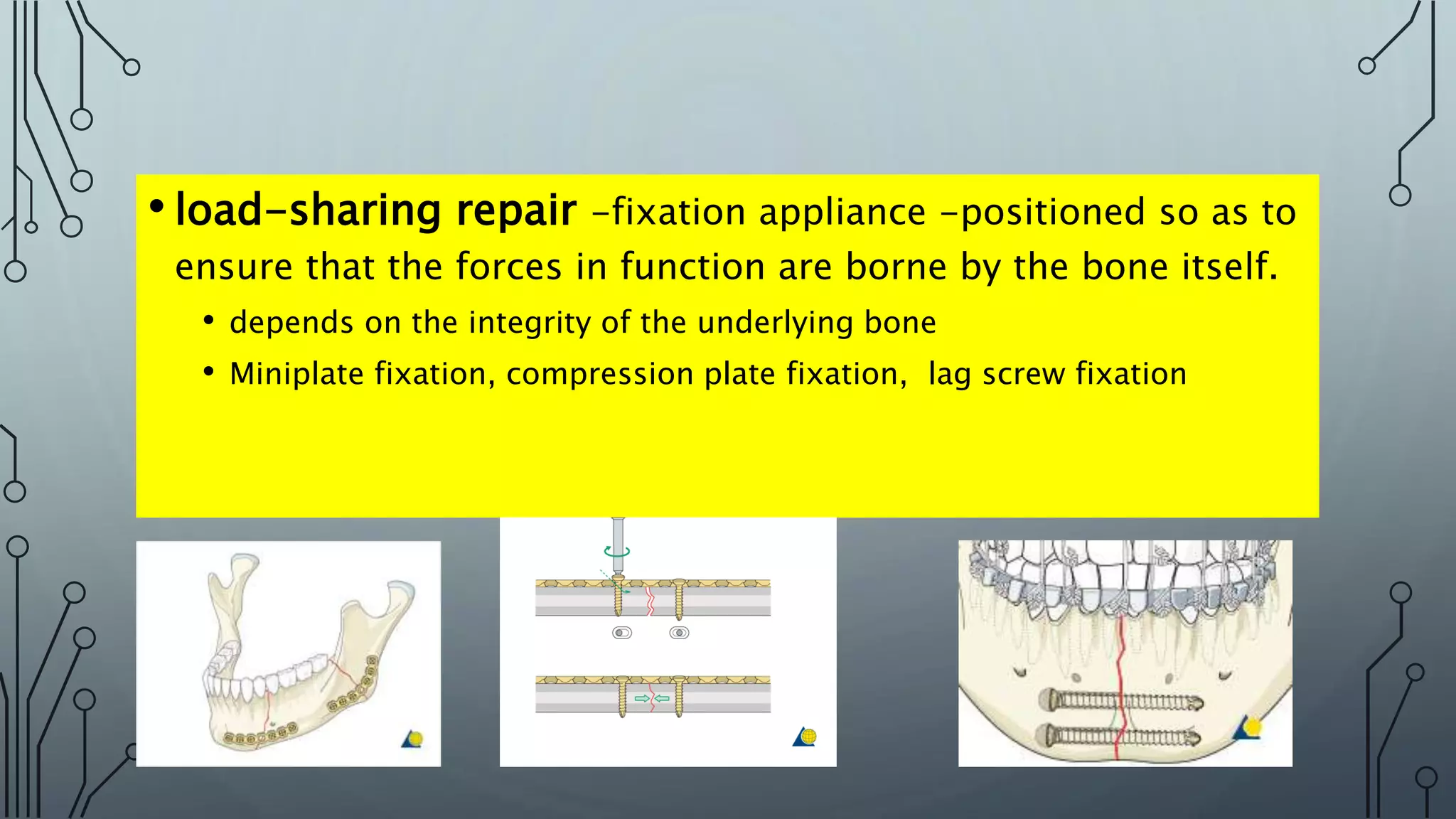 9. facial reconstructive surgery maxillofacial trauma | PPT