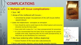 9. facial reconstructive surgery maxillofacial trauma | PPT