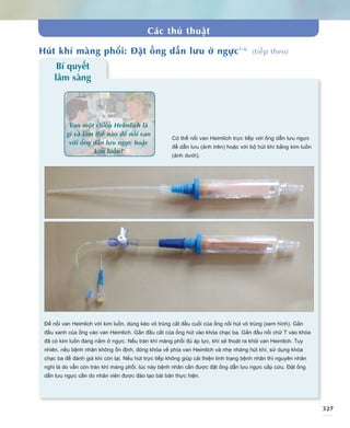 9. p. 303 to 328 procedures slides vietnamese | PDF