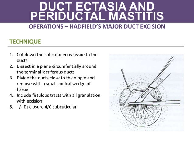 Benign and Malignant Breast Diseases