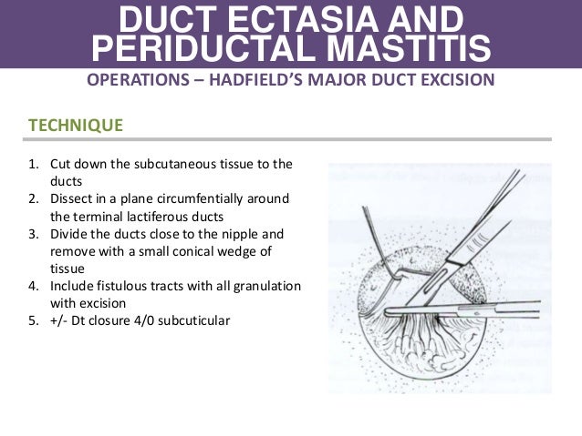 Benign and Malignant Breast Diseases