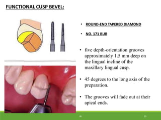 posterior partial veneer crowns - Kelly | PPTX