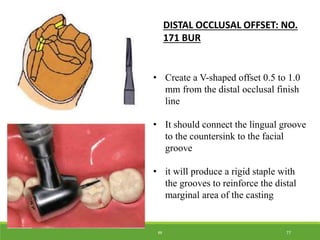 posterior partial veneer crowns - Kelly | PPTX