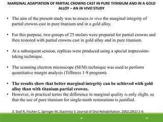 posterior partial veneer crowns - Kelly | PPTX