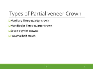 posterior partial veneer crowns - Kelly | PPTX