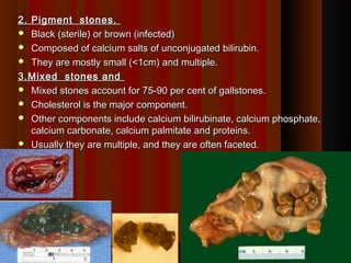 9.gall bladder | PPT