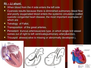 9.Congenital heart disease | PPT