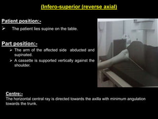9. radiography of shoulder | PPTX
