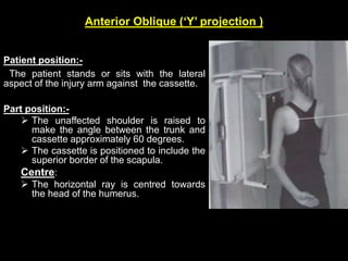 9. radiography of shoulder | PPTX