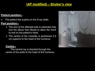 9. radiography of shoulder | PPTX