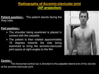 9. radiography of shoulder | PPTX