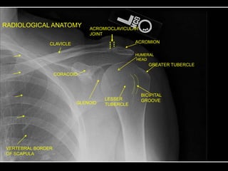 9. radiography of shoulder | PPTX
