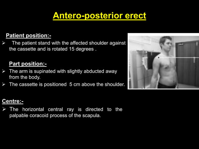 9. radiography of shoulder | PPTX