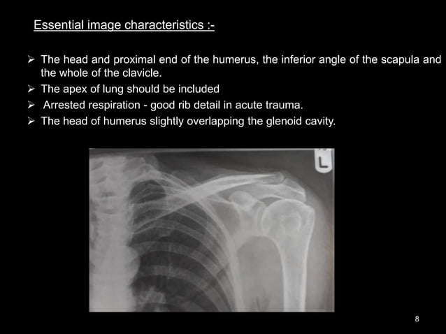 9. radiography of shoulder | PPTX