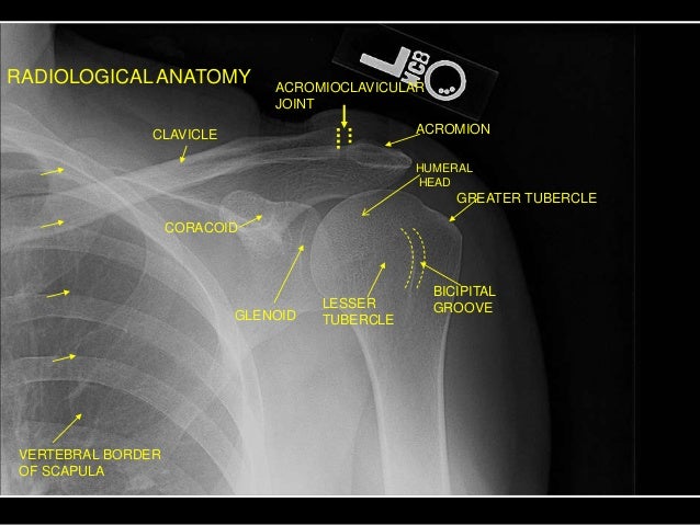 9. radiography of shoulder