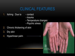 9. Eczema & dermatitis | PPTX