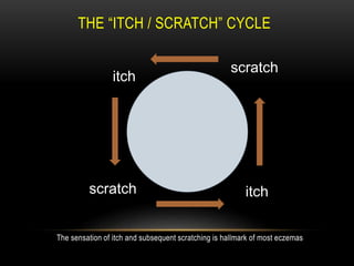 9. Eczema & dermatitis | PPTX
