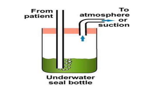 water seal drainage | PPT