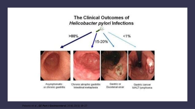 Biopsia por endoscopia