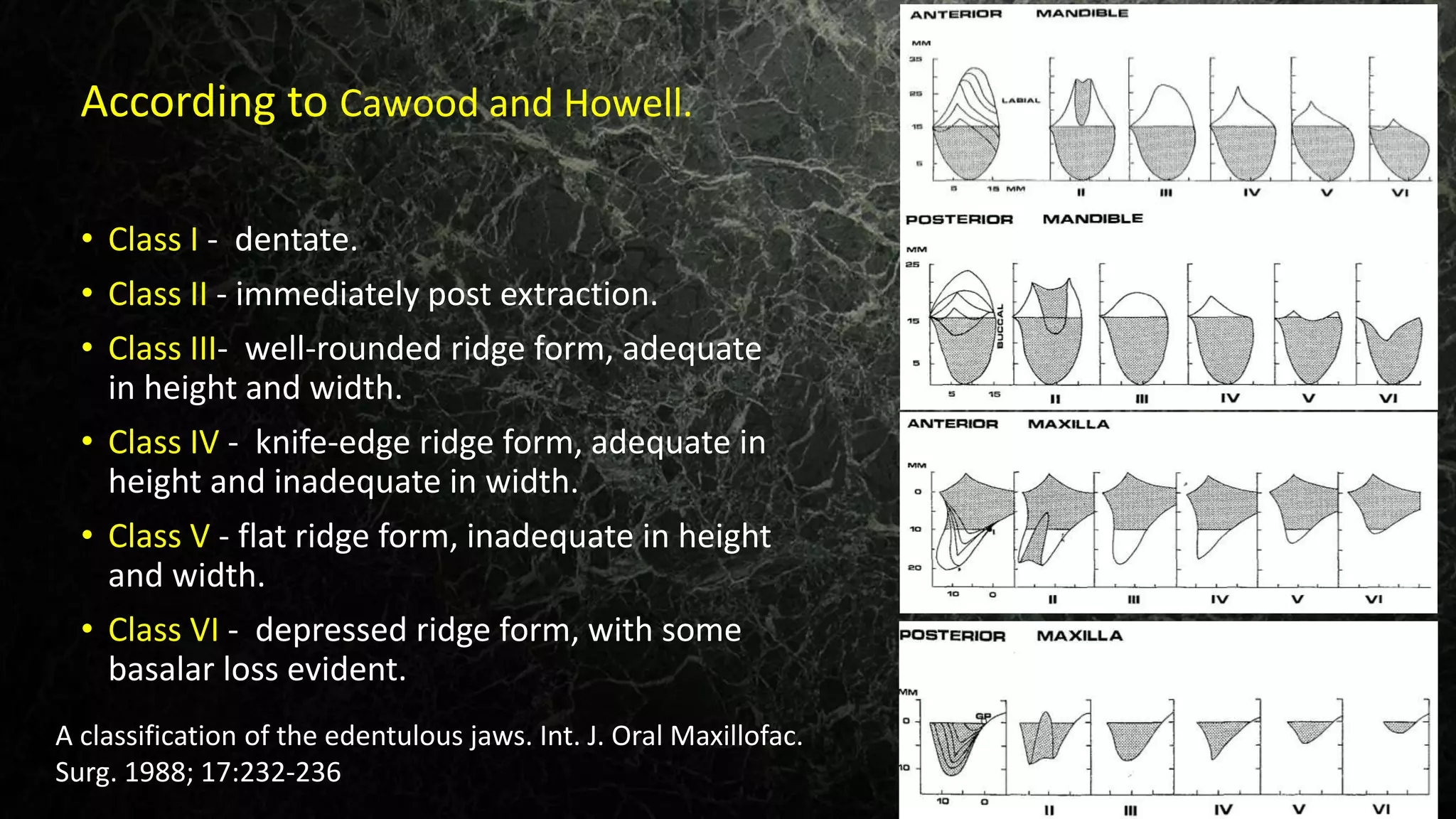 residual ridge resorption | PPTX | Bone and Joint Conditions | Diseases ...