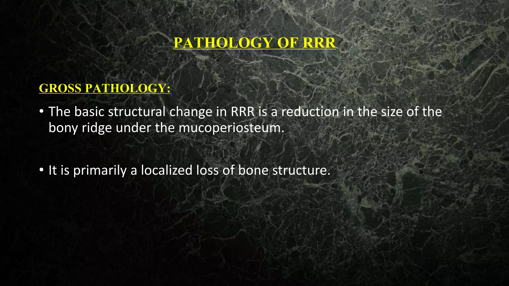 residual ridge resorption | PPTX