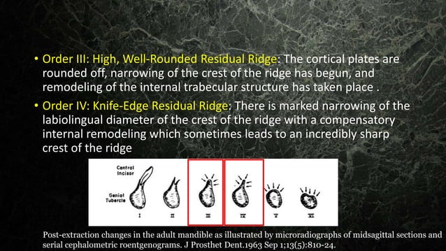 residual ridge resorption | PPTX | Bone and Joint Conditions | Diseases ...