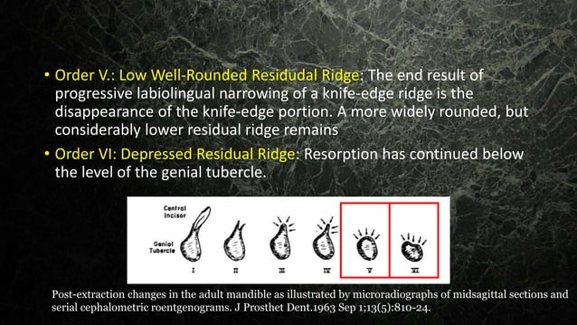 residual ridge resorption | PPTX | Bone and Joint Conditions | Diseases ...