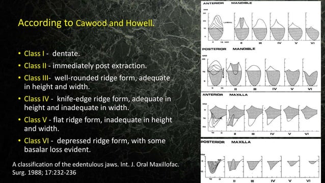 residual ridge resorption | PPTX | Bone and Joint Conditions | Diseases ...