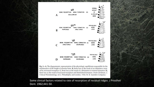 residual ridge resorption | PPTX | Bone and Joint Conditions | Diseases ...