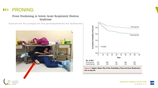 9. mechanical ventilation during ecmo and eccor techniques #beach2019 ...