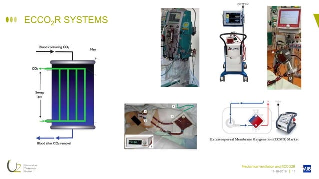 9. mechanical ventilation during ecmo and eccor techniques #beach2019 ...