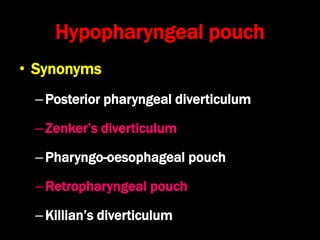 Hypopharyngeal pouch and stylalgia | PPT