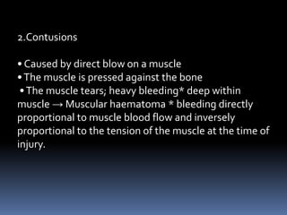 Physiotherapy Management in Soft Tissue Injury | PPTX