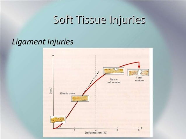 Physiotherapy Management in Soft Tissue Injury | PPTX