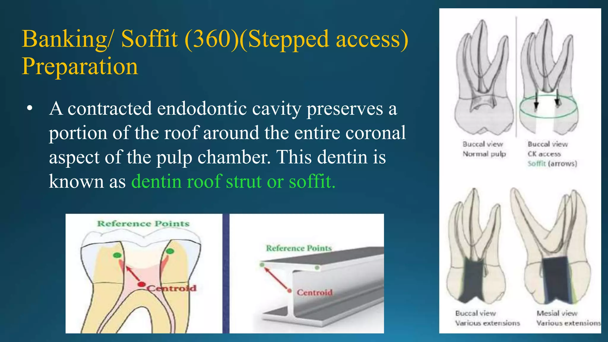 Modern Access Cavity Preparation | PPTX