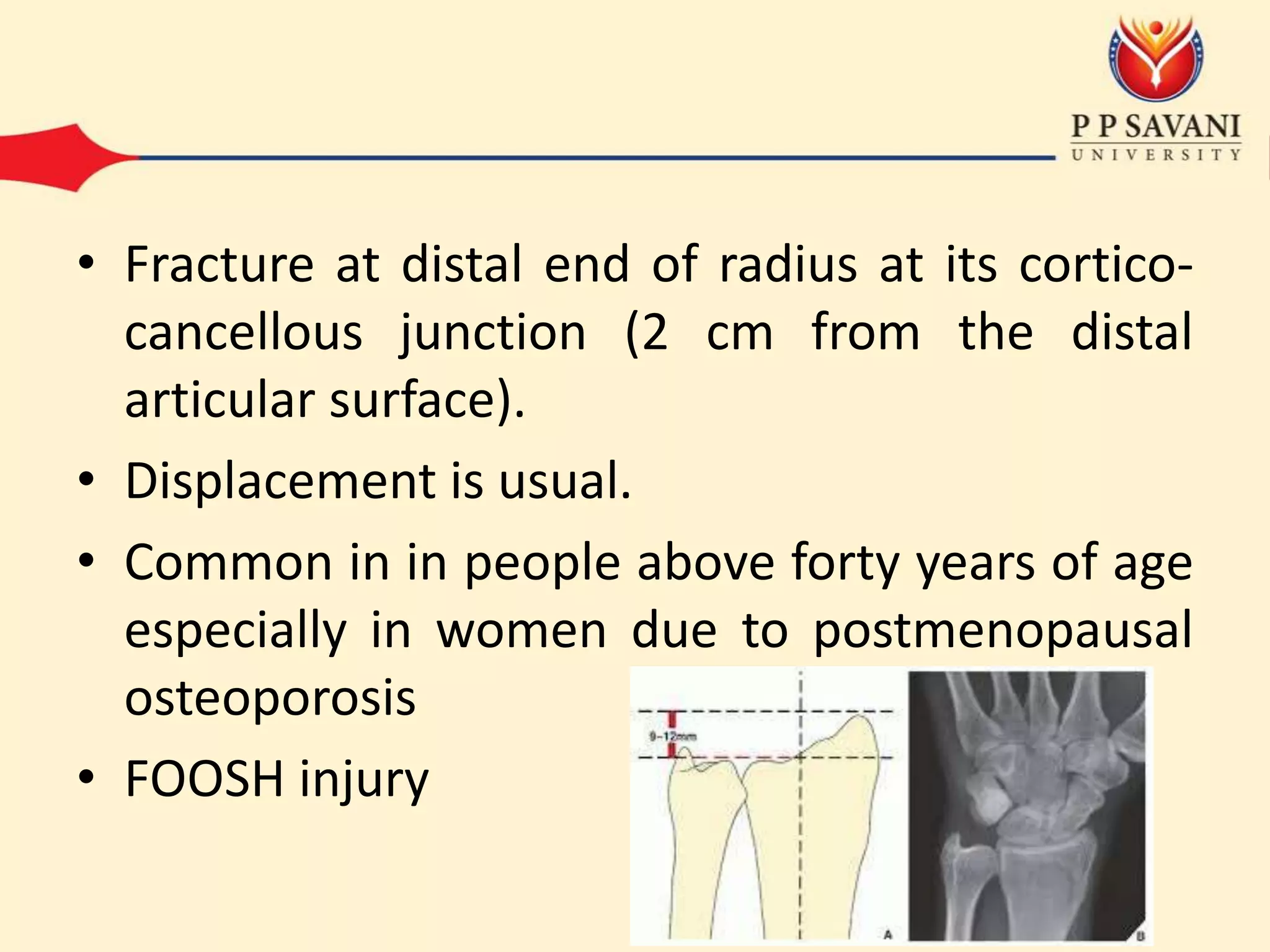 9. Forearm lower end fractures | PPT