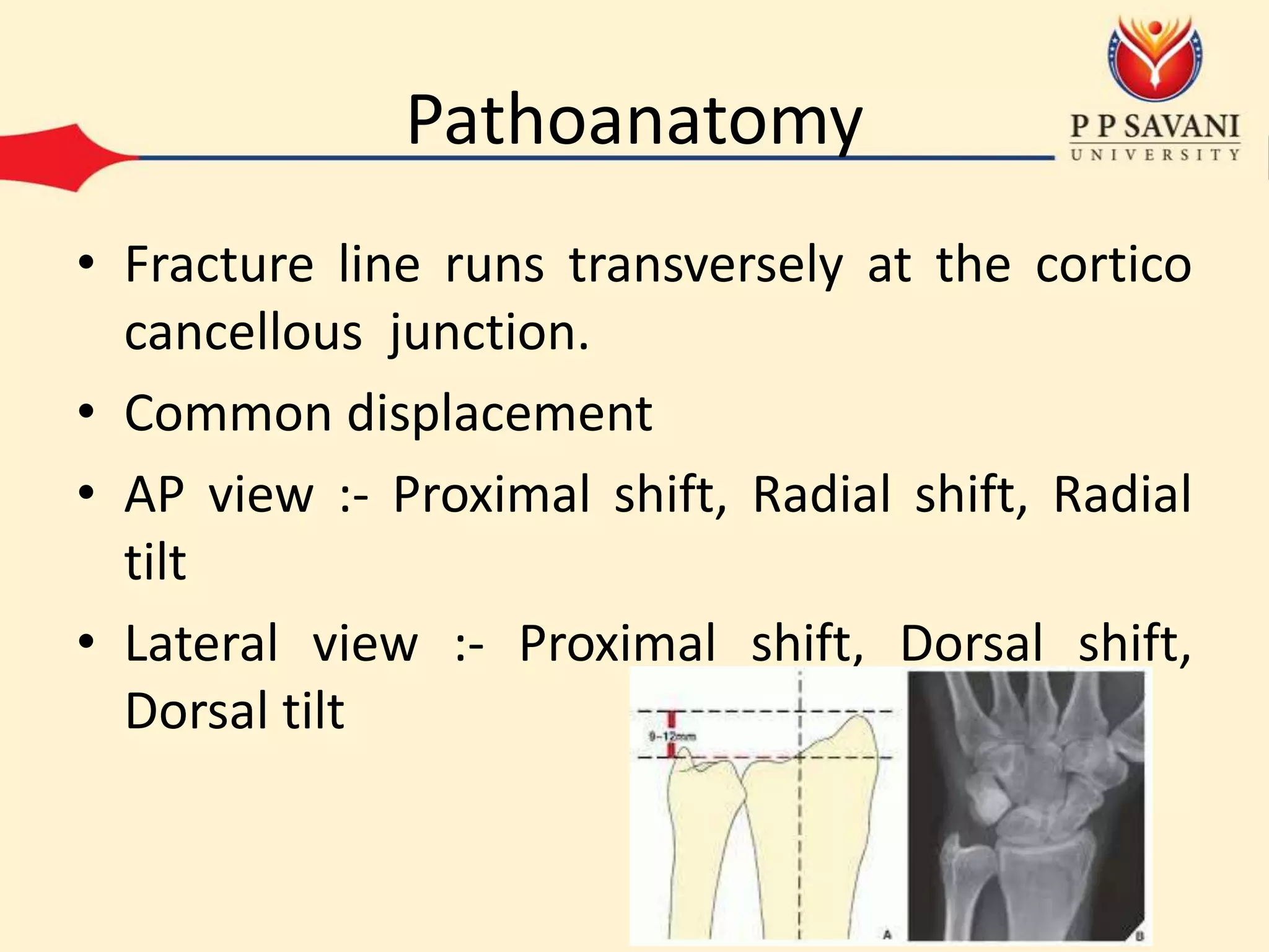 9. Forearm lower end fractures | PPT