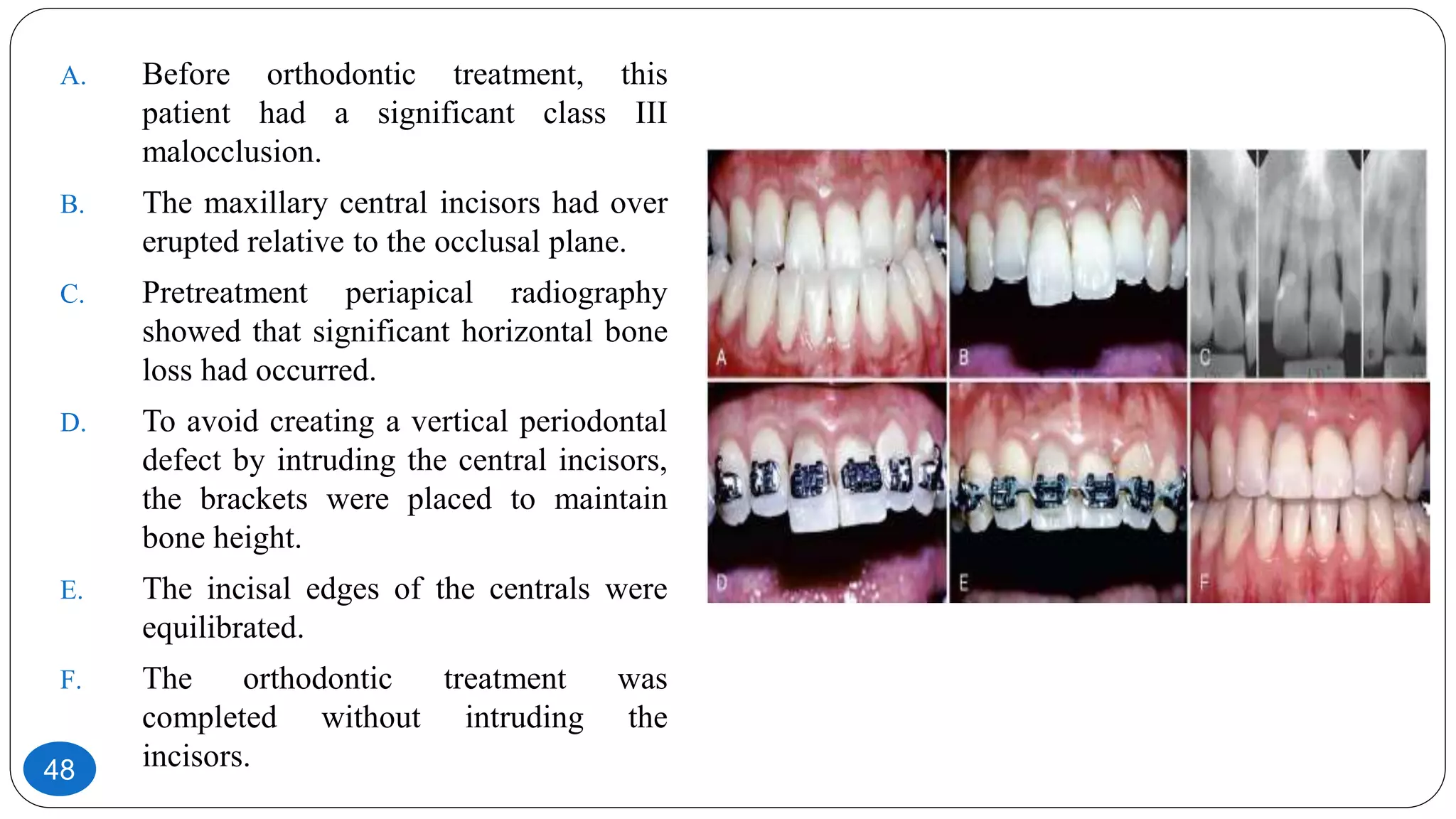 Perio-Ortho Interdisciplinary approch | PPTX